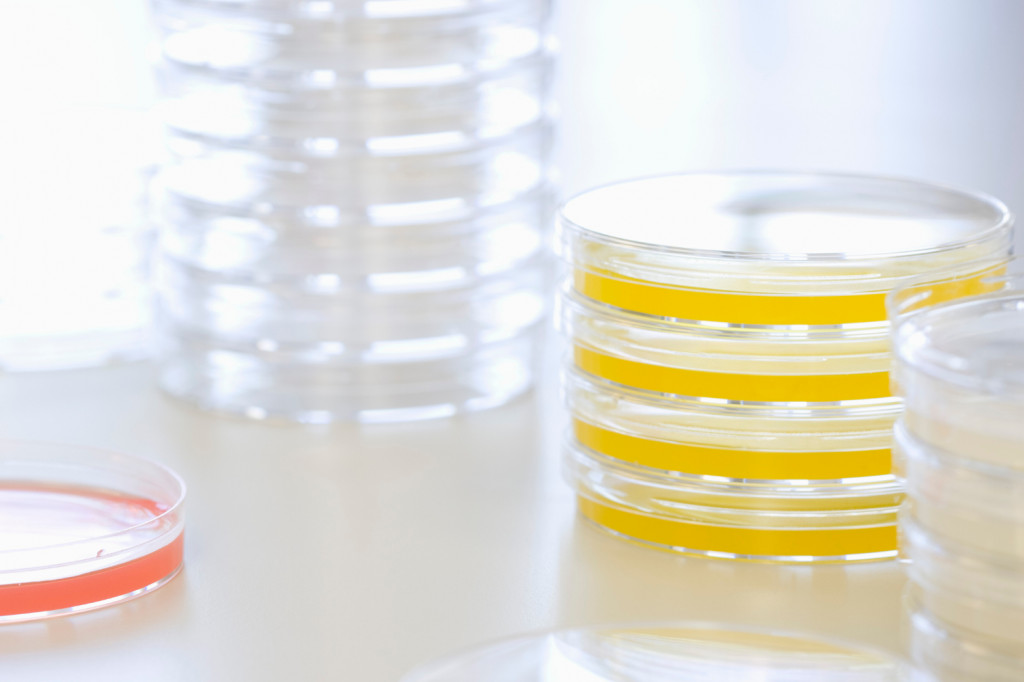 STREAKING A PLATE IN 2022 - Simport